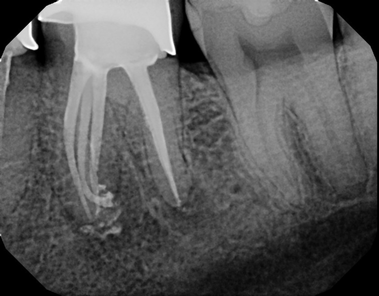 Endodontics - Magnolia Endo